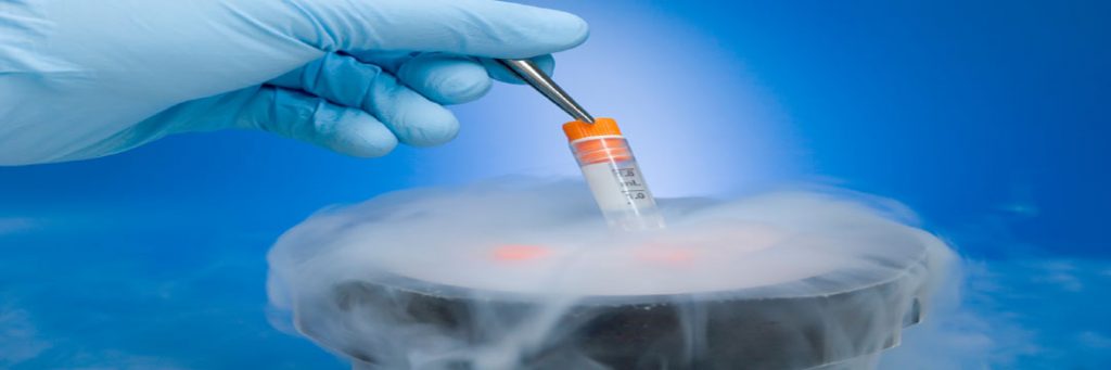 Direction and Trends in Cryopreservation