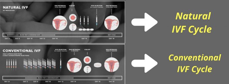 Differences between Natural IVF cycle and Conventional IVF Cycle