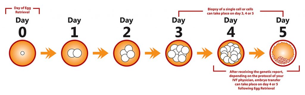 PGD Treatment in Delhi, Preimplantation Genetic Diagnosis in India